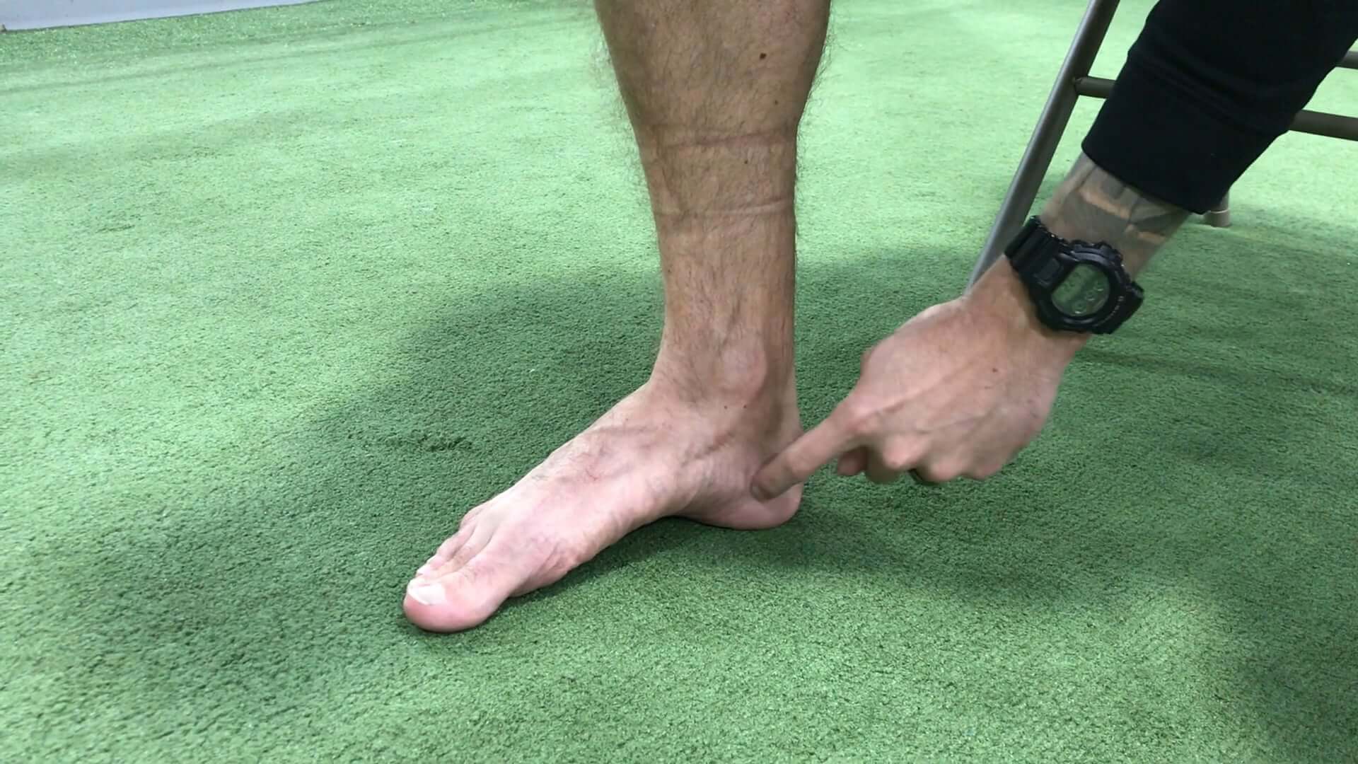 Foot Doming - [P]rehab