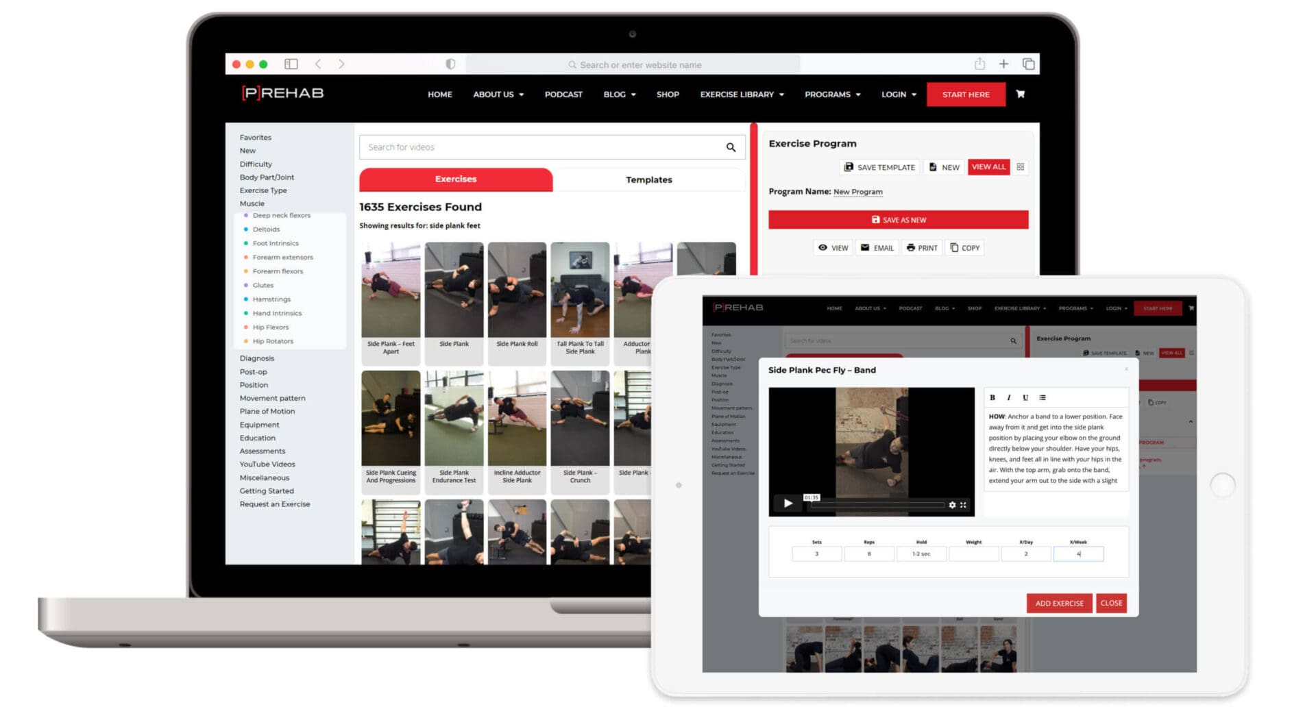 Prehab Exercise Library Access - [P]rehab