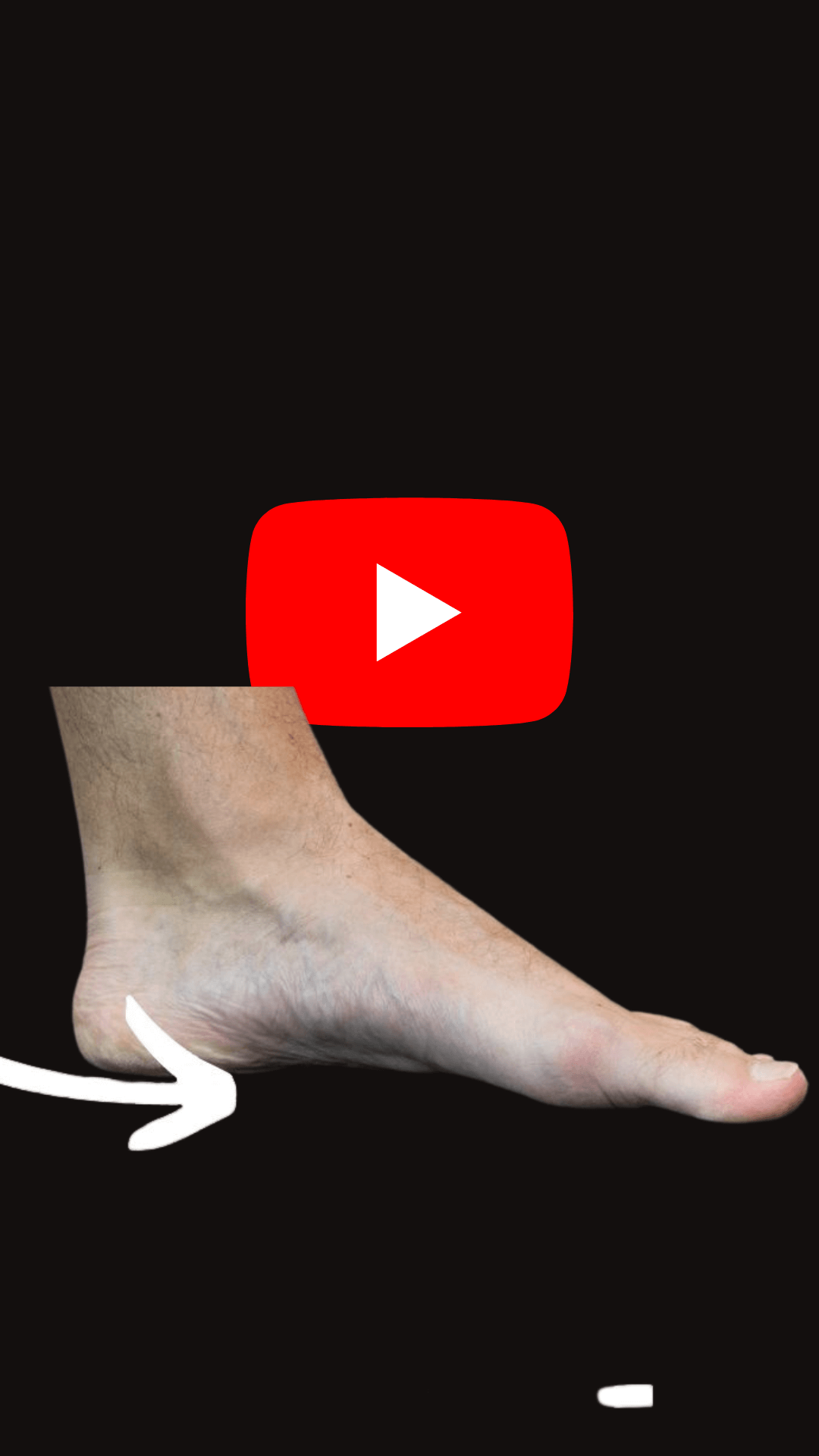 Foot Arch Strengthening Exercises at Thelma Guerrero blog